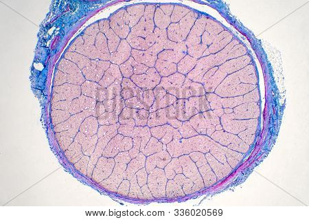 Human Eye Nerve Under Image & Photo (Free Trial) | Bigstock