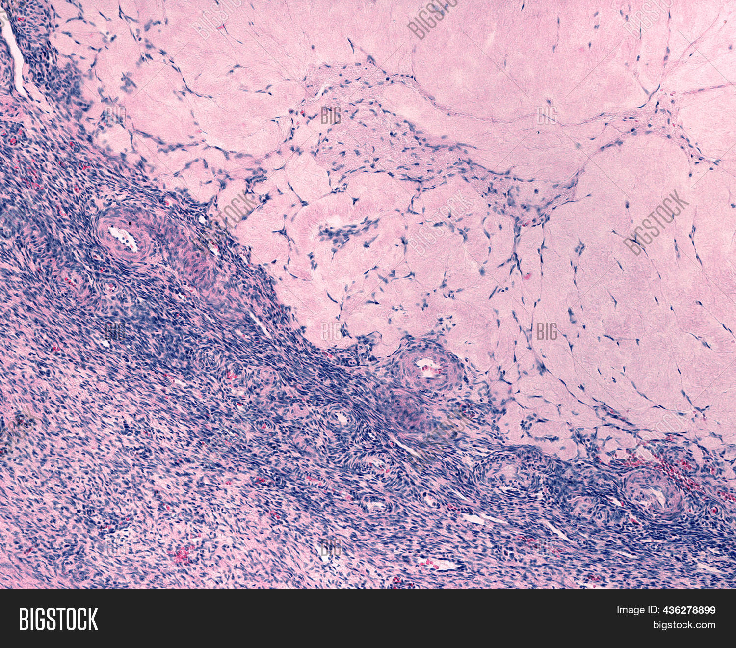 Corpus Albicans. Human Image & Photo (Free Trial) | Bigstock