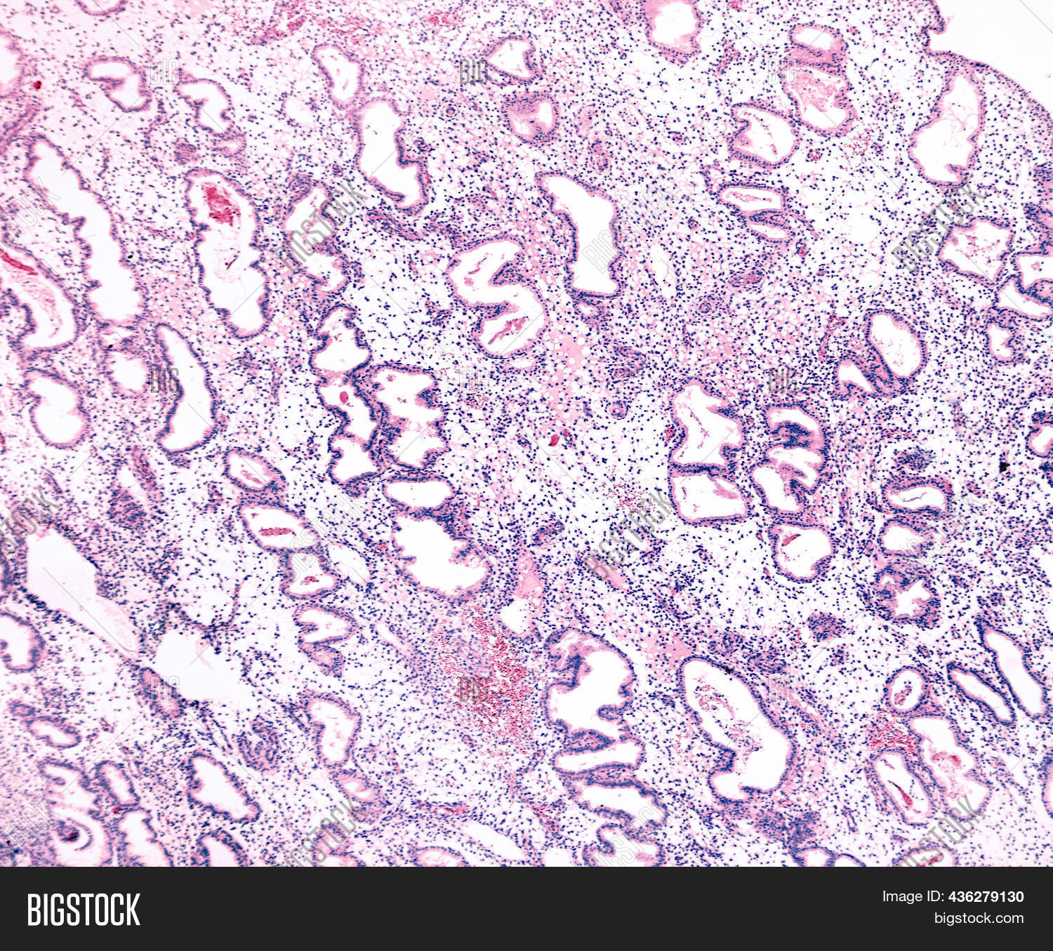 Endometrium 图片和照片（免费试用） | Bigstock