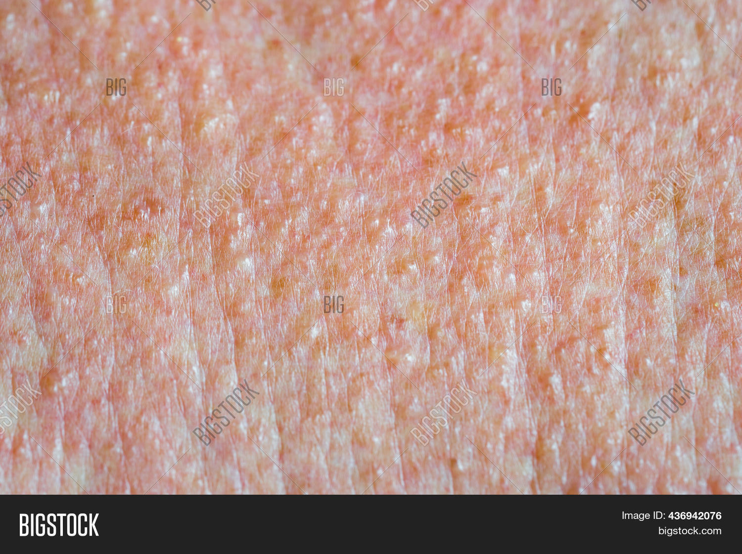 Skin Texture Painful Image & Photo (Free Trial) | Bigstock