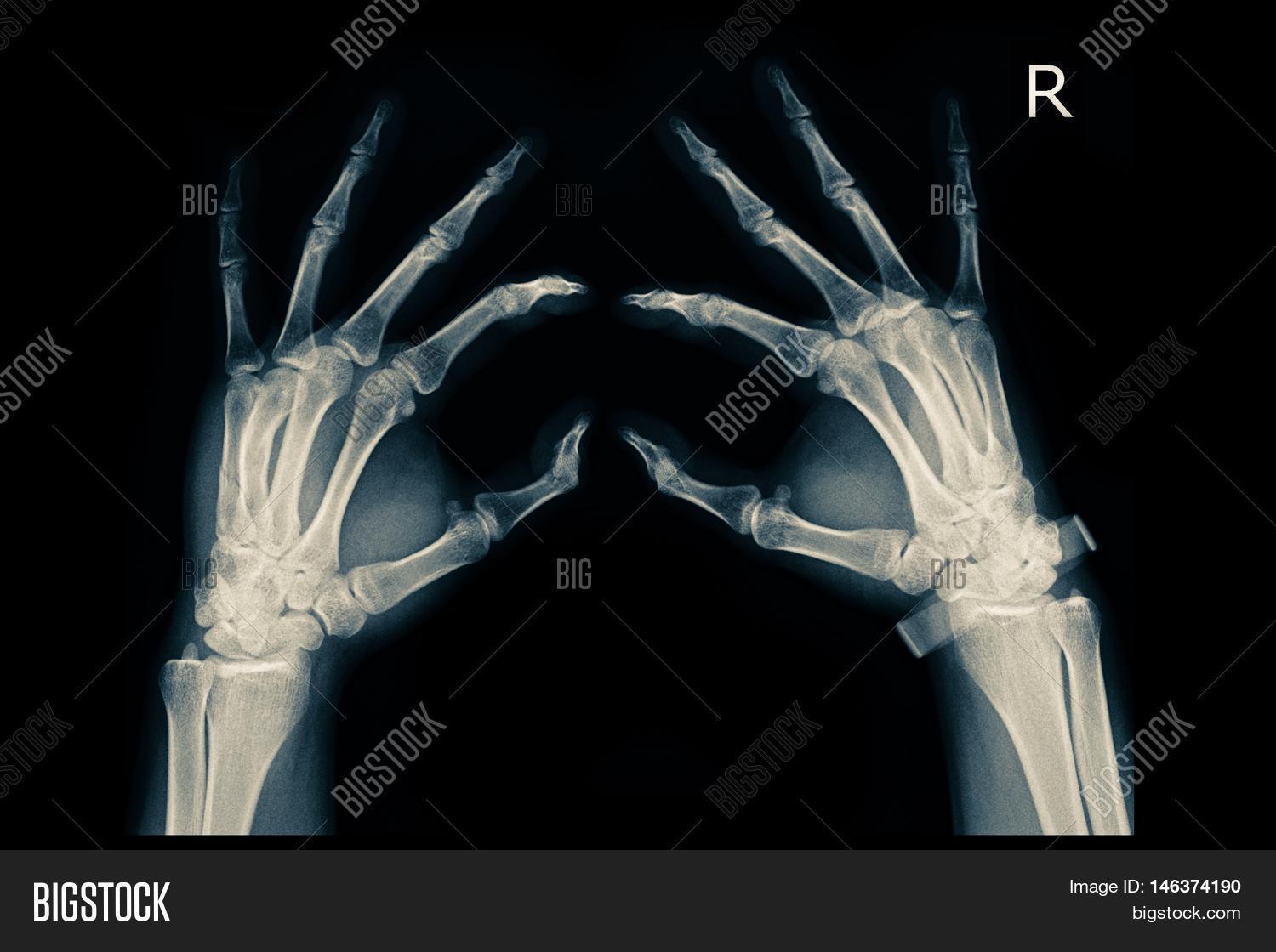 Xray Image Show Both Image & Photo (Free Trial) | Bigstock