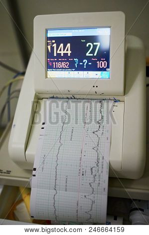 Cardiotocograph Image & Photo (Free Trial) | Bigstock