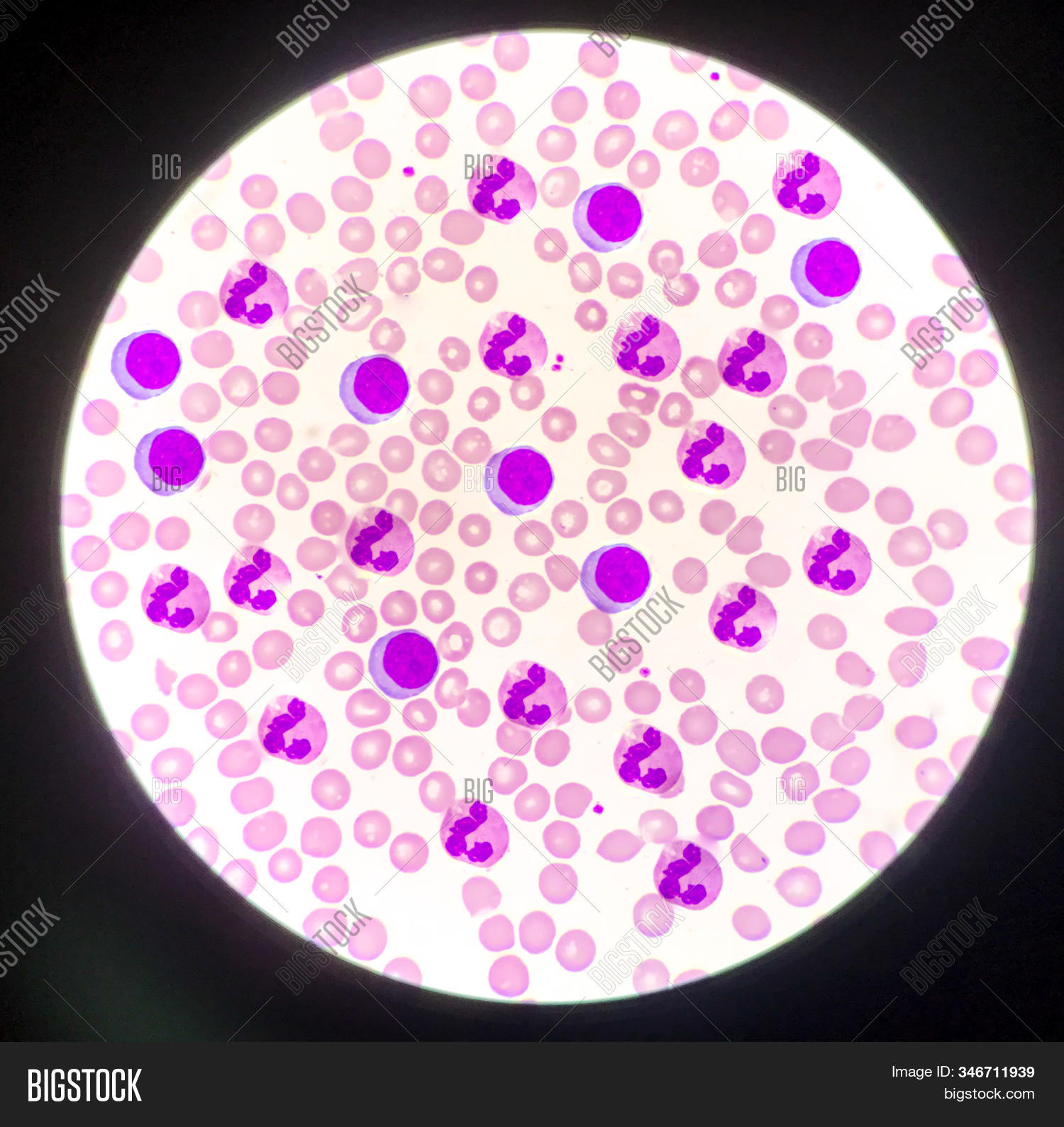 White Blood Cells On Image & Photo (Free Trial) | Bigstock