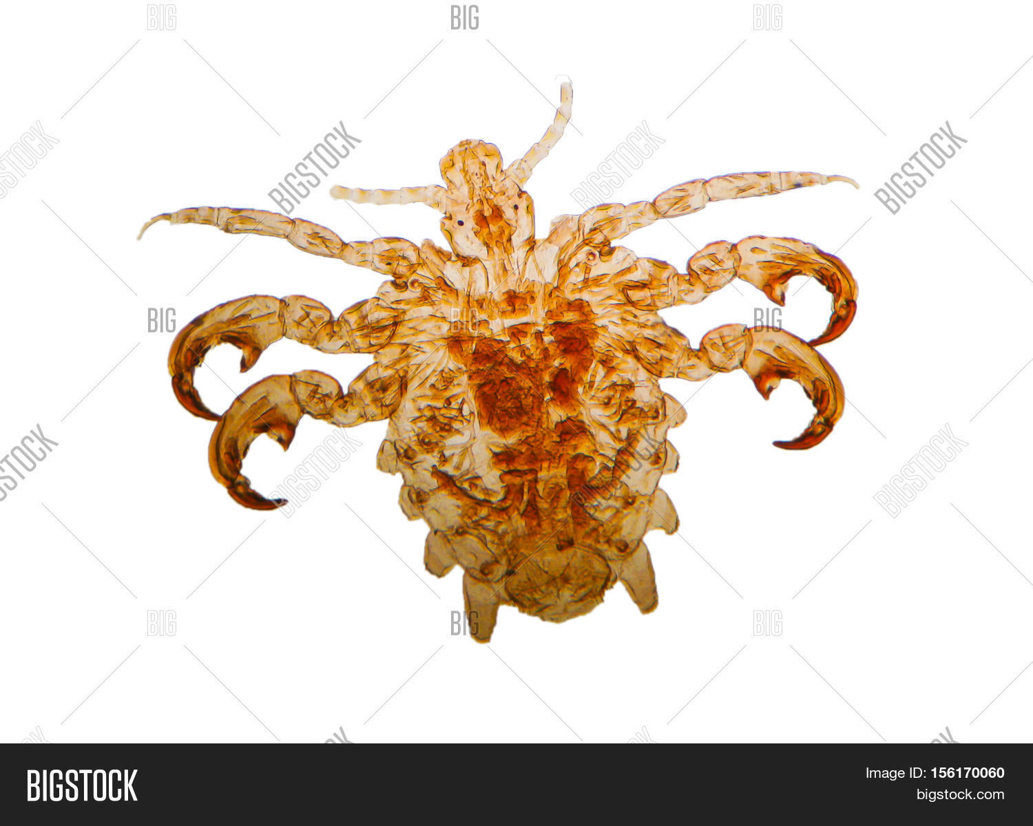 Pediculus Humanus - Image & Photo (Free Trial) | Bigstock