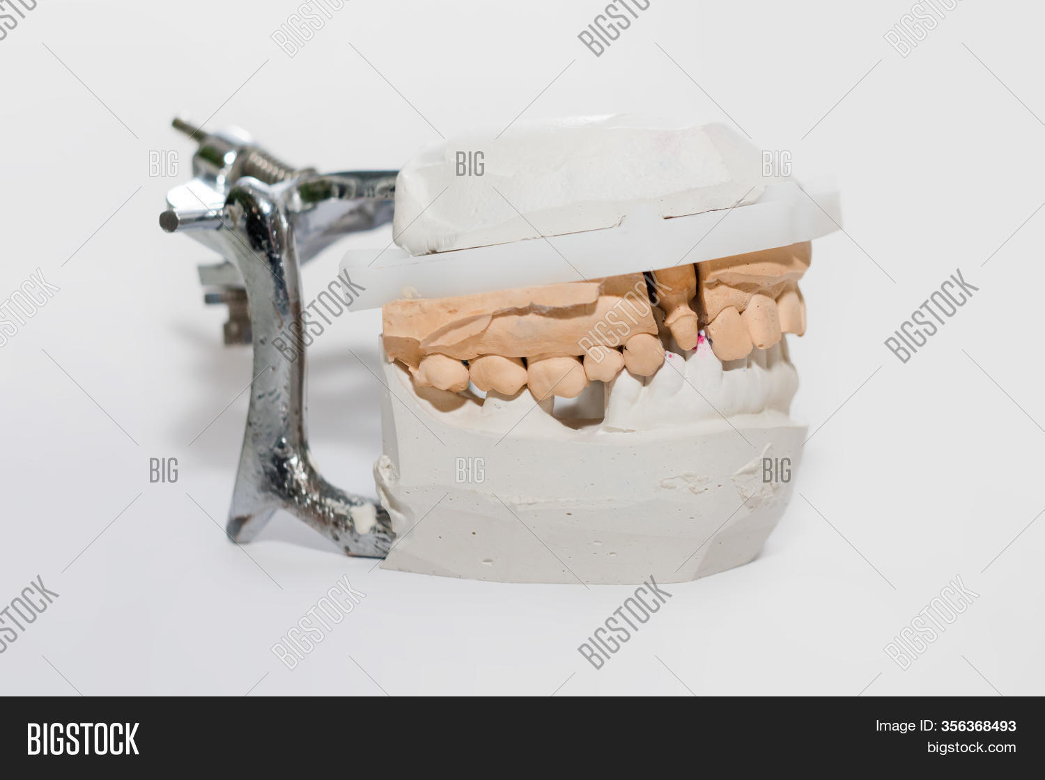 Plaster Cast Jaws. Image & Photo (Free Trial) | Bigstock