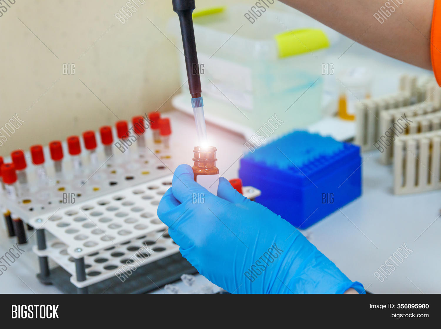 Blood Samples Research Image & Photo (Free Trial) | Bigstock