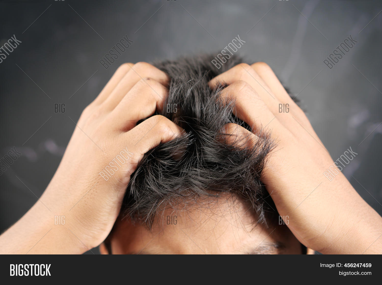 Teenage Boy Scratching Image & Photo (Free Trial) | Bigstock