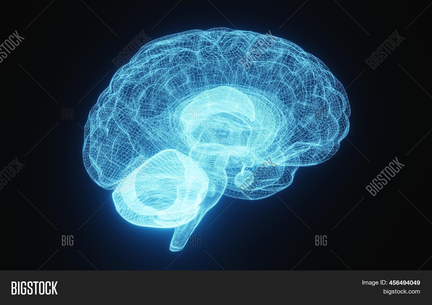 Glowing X-ray Image Image & Photo (Free Trial) | Bigstock