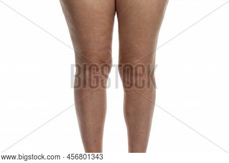 Thick Female Legs Image & Photo (Free Trial) | Bigstock