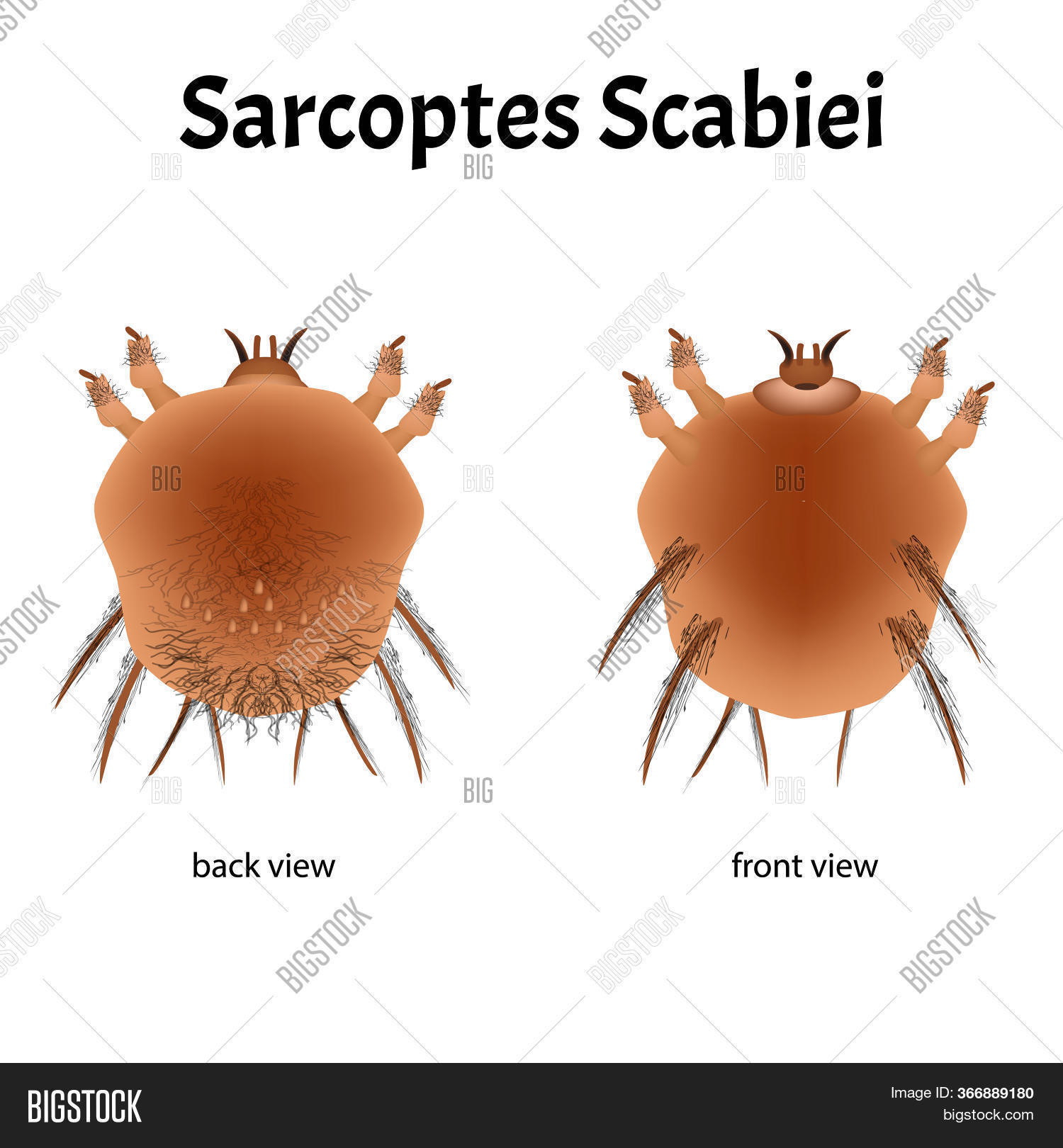 Sarcoptes Scabiei. Image & Photo (Free Trial) | Bigstock