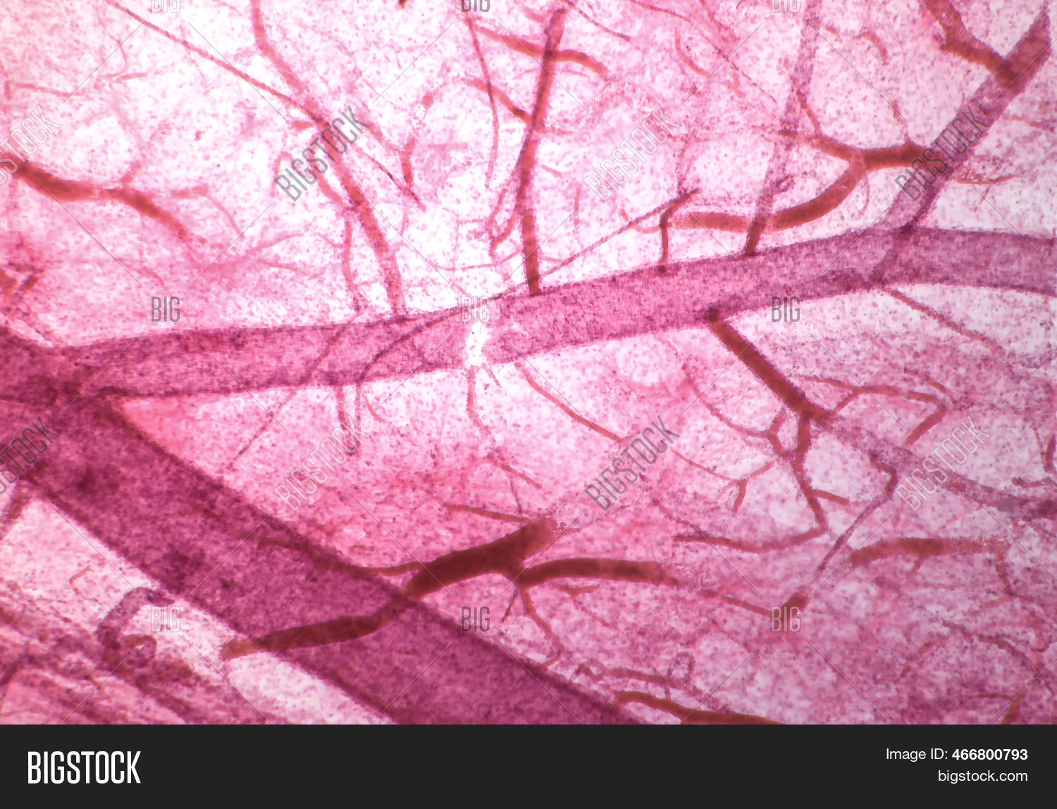 Capillaries. Light Image & Photo (Free Trial) | Bigstock