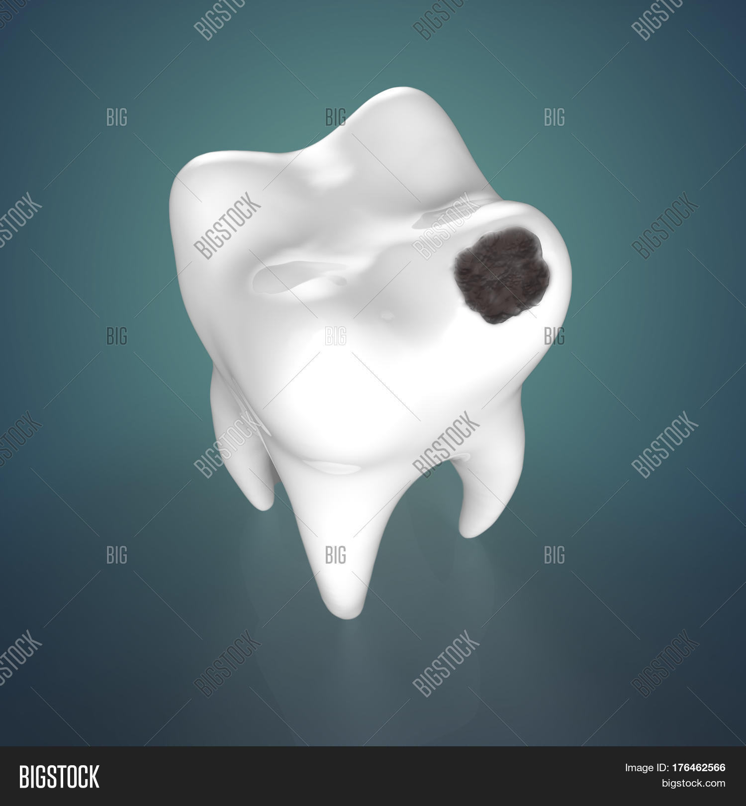 Human Tooth Black Hole Image & Photo (Free Trial) | Bigstock