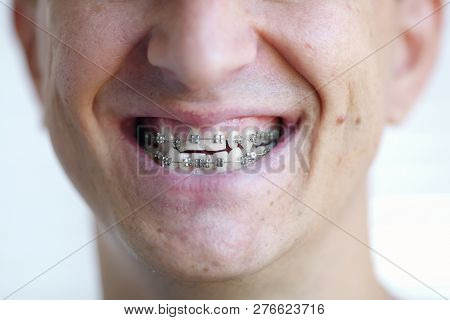 Portrait Man Crooked Image & Photo (Free Trial) | Bigstock