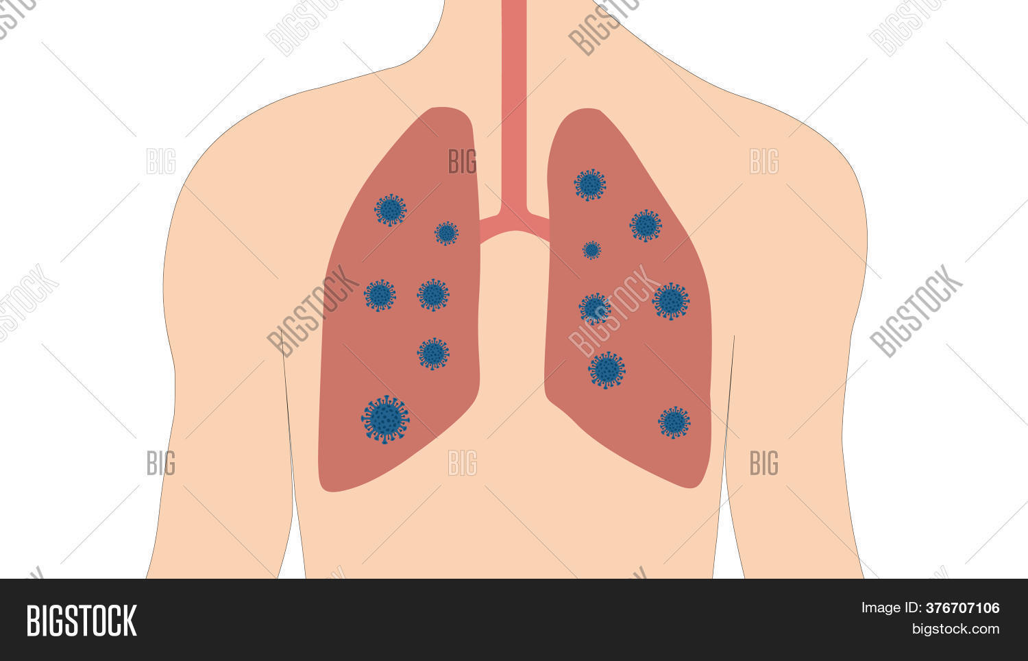 Virus Human Image & Photo (Free Trial) | Bigstock