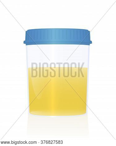 Urine Sample Specimen Vector & Photo (Free Trial) | Bigstock