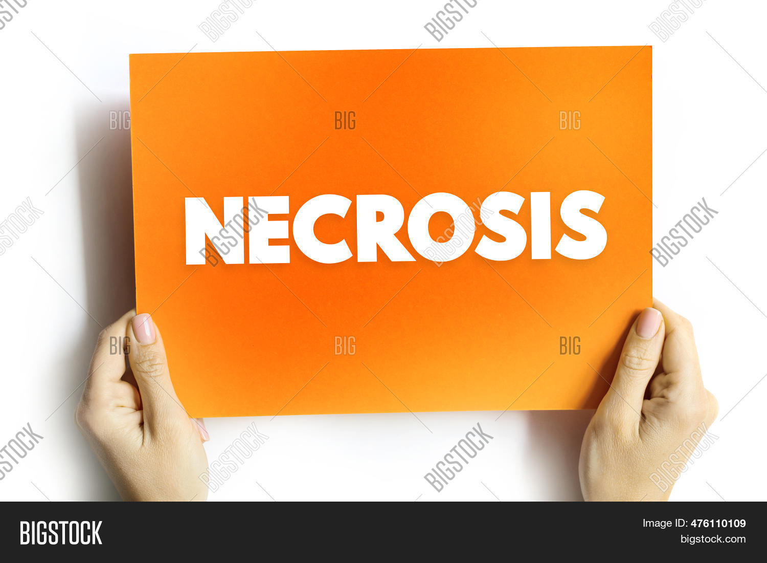 Necrosis Death Body Image & Photo (Free Trial) | Bigstock