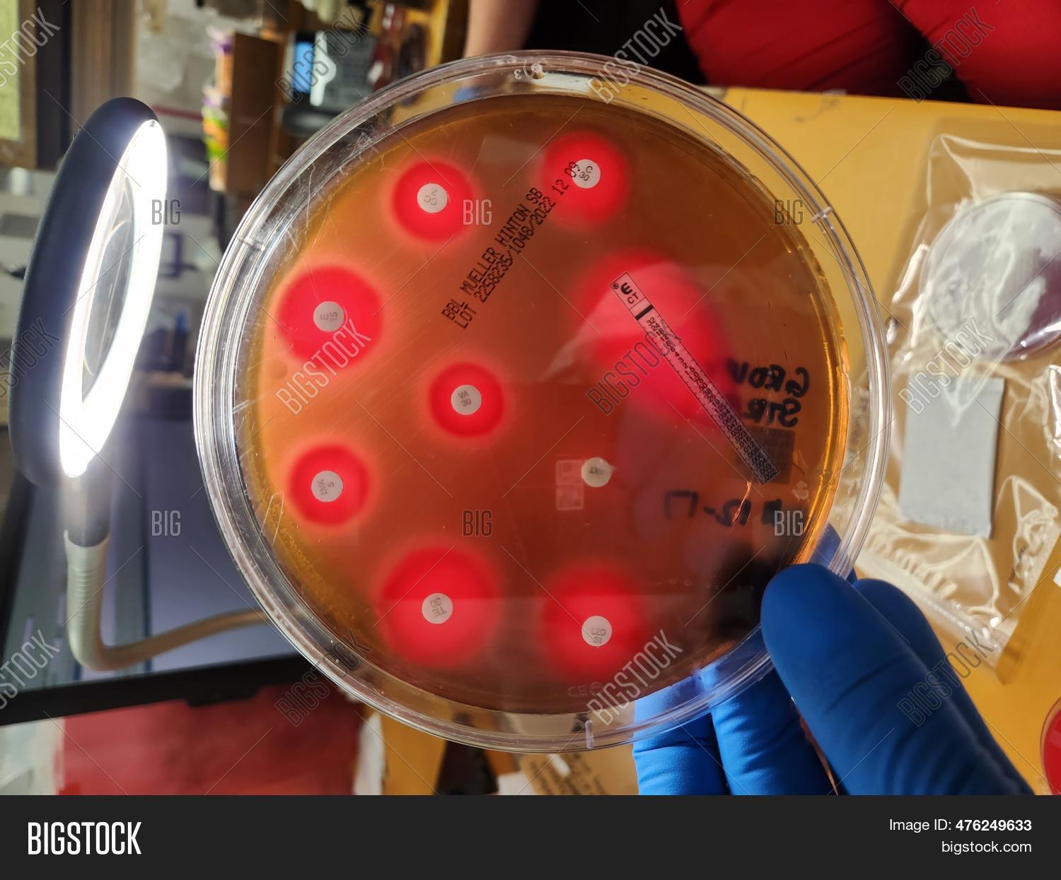 Streptococcal Image & Photo (Free Trial) | Bigstock