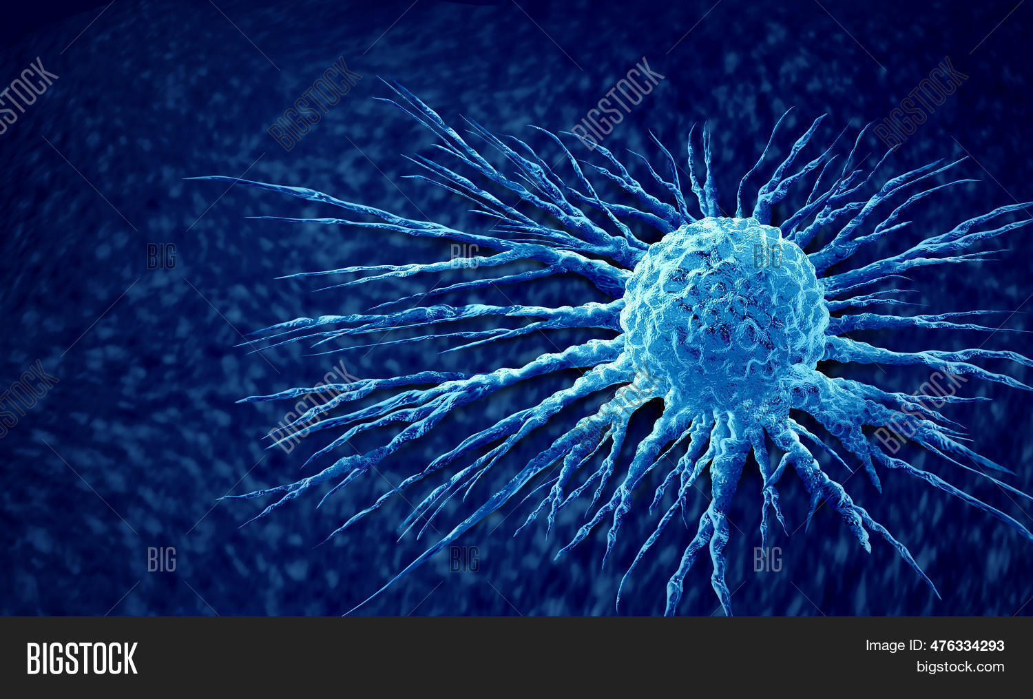 Cancer Cell Spread Image & Photo (Free Trial) | Bigstock