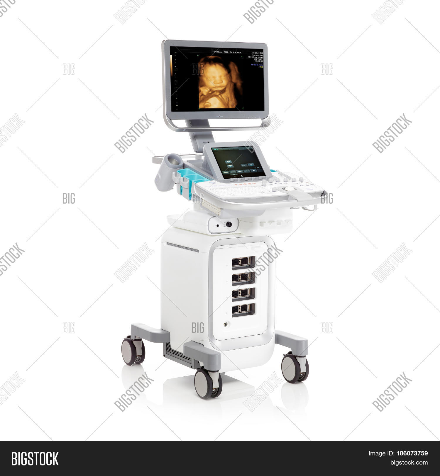 Ultrasound Machine Image & Photo (Free Trial) | Bigstock