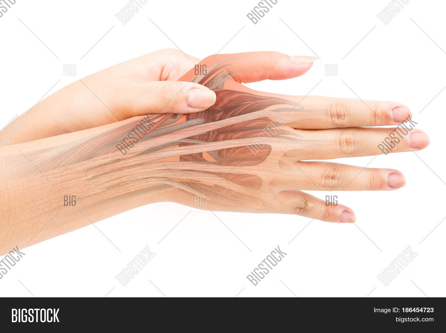 Finger Muscle Pain Image & Photo (Free Trial) | Bigstock