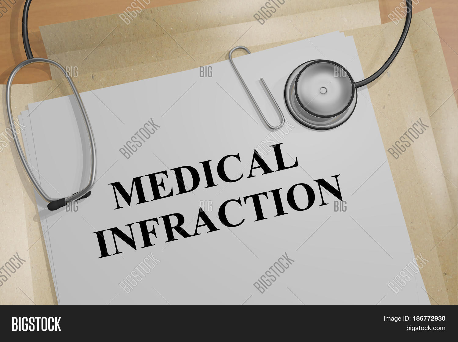 Medical Infraction Image & Photo (Free Trial) | Bigstock