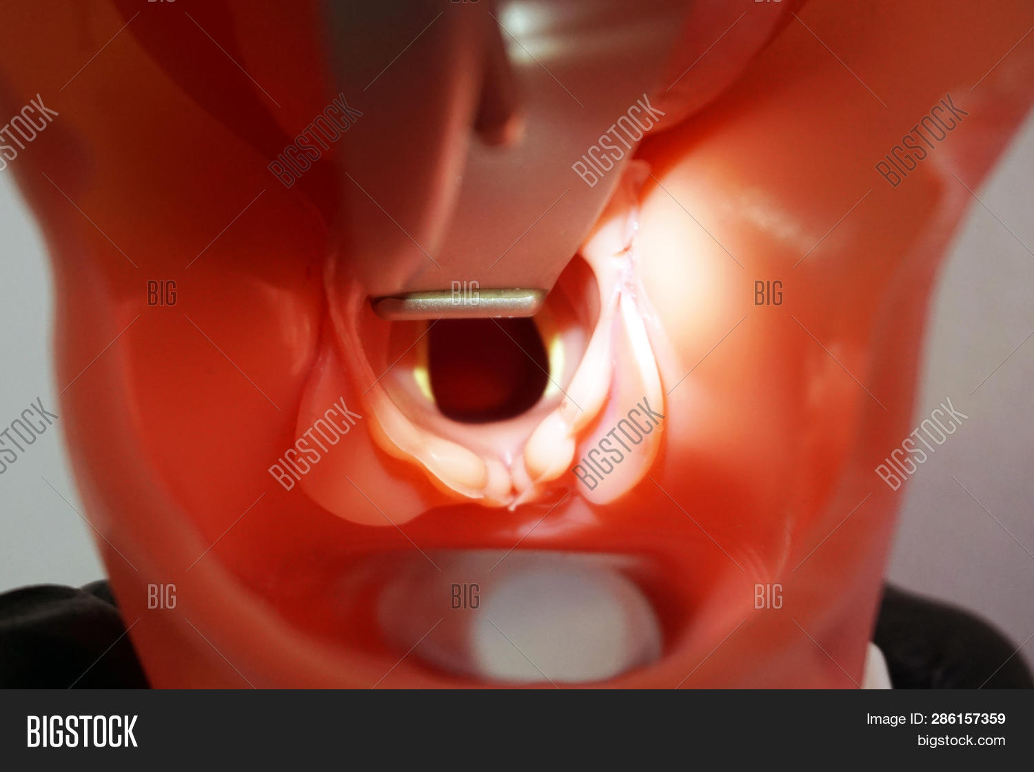 Intubation Tube Image & Photo (Free Trial) | Bigstock