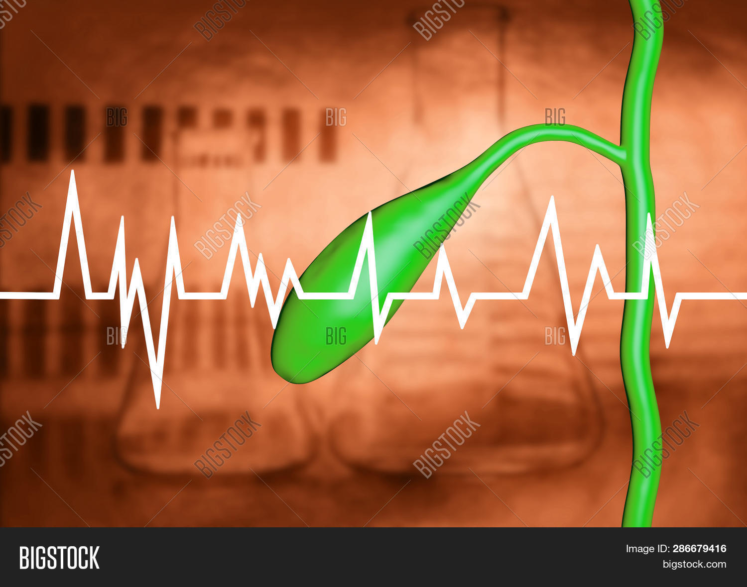 Enlarged Gallbladder Image & Photo (Free Trial) | Bigstock