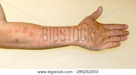 Photocontact Image & Photo (Free Trial) | Bigstock