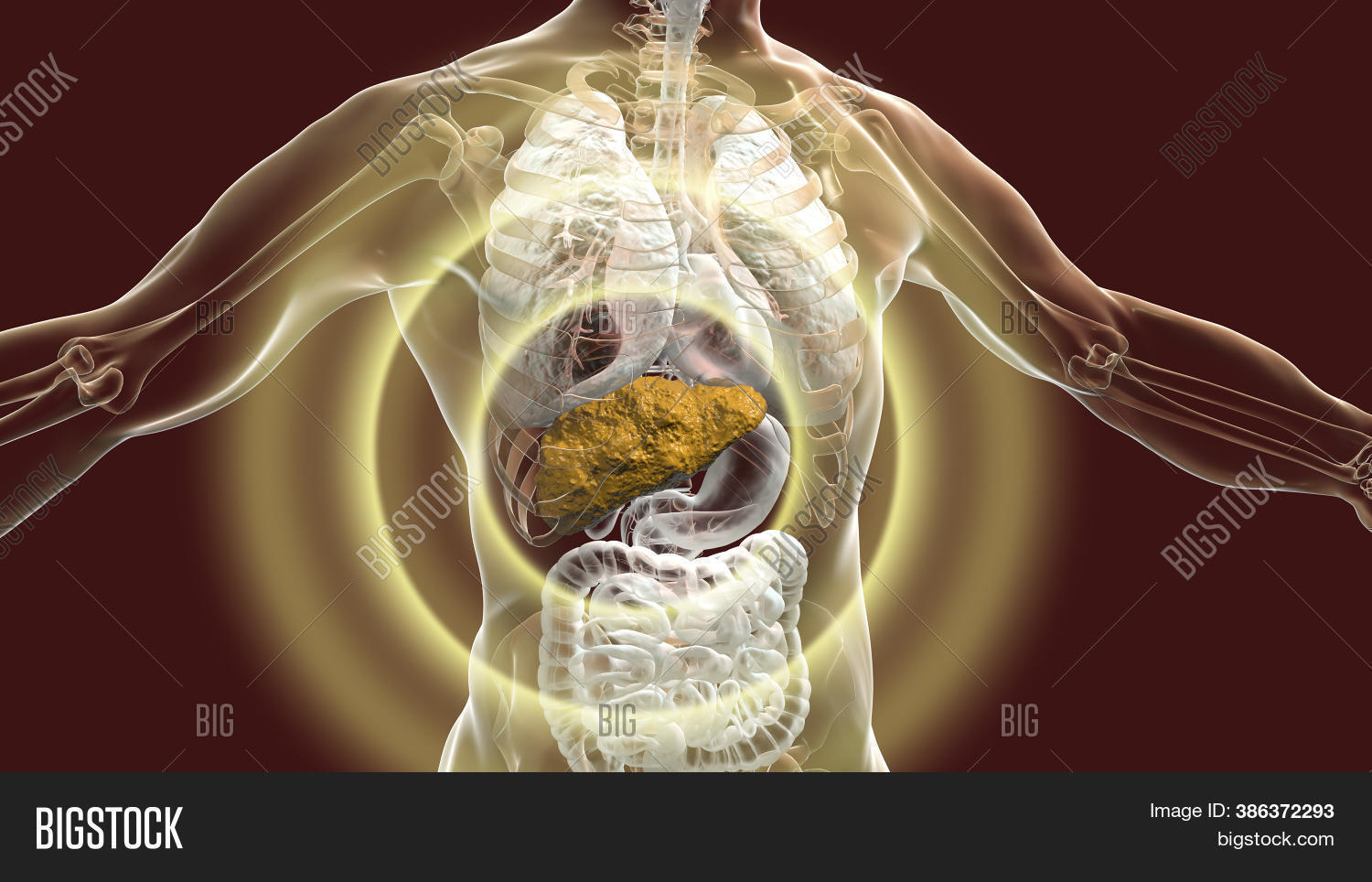 Liver Cirrhosis Inside Image & Photo (Free Trial) | Bigstock