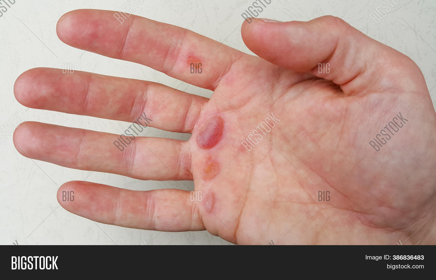 Calloused Palm Working Image & Photo (Free Trial) | Bigstock