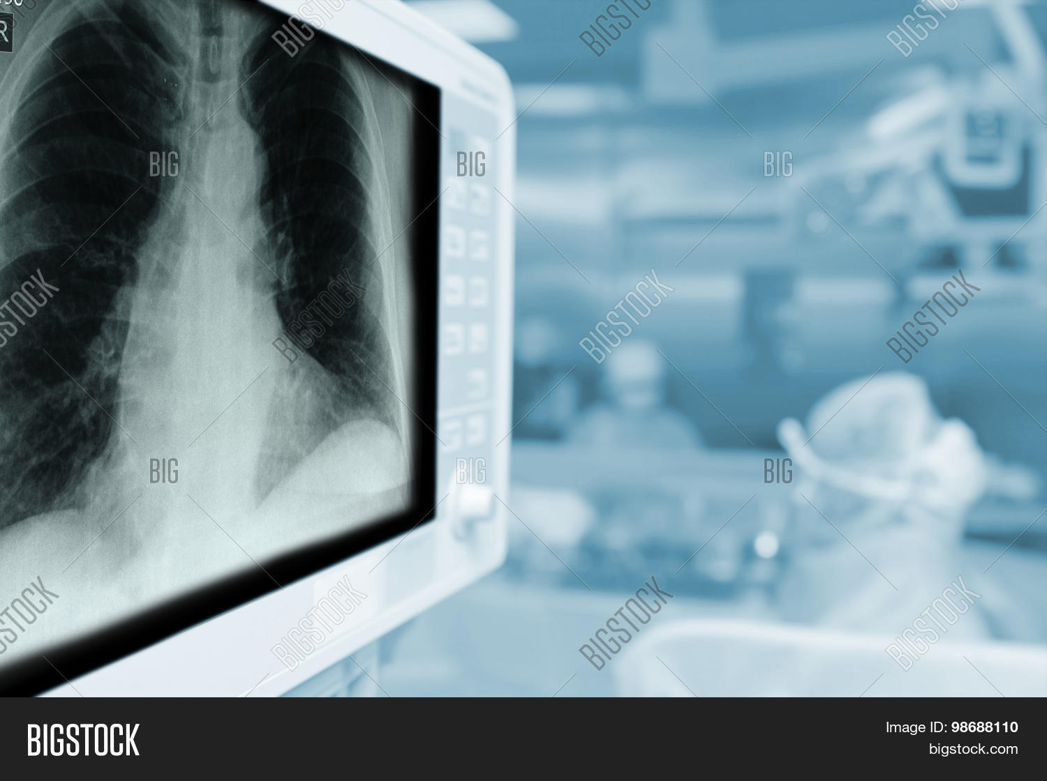 X-ray Monitor During Image & Photo (Free Trial) | Bigstock