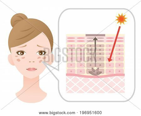 Infographic Skin Image & Photo (Free Trial) | Bigstock