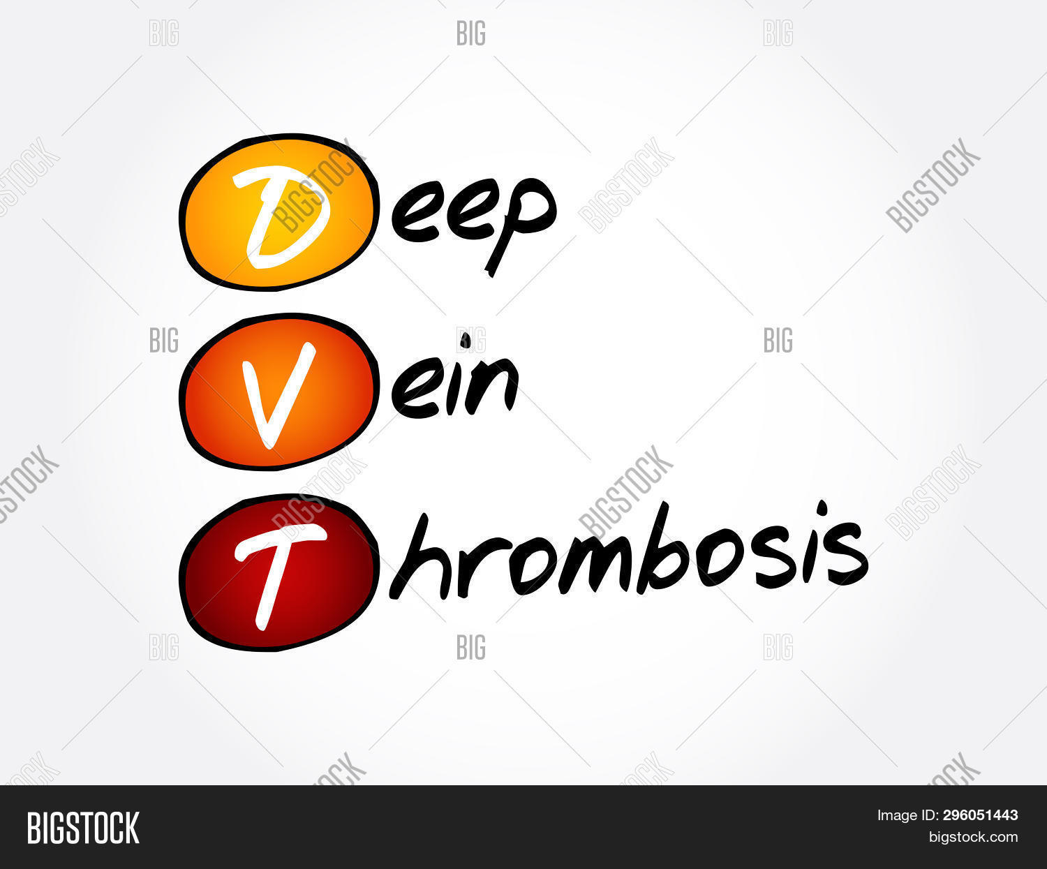 Dvt - Deep Vein Image & Photo (Free Trial) | Bigstock