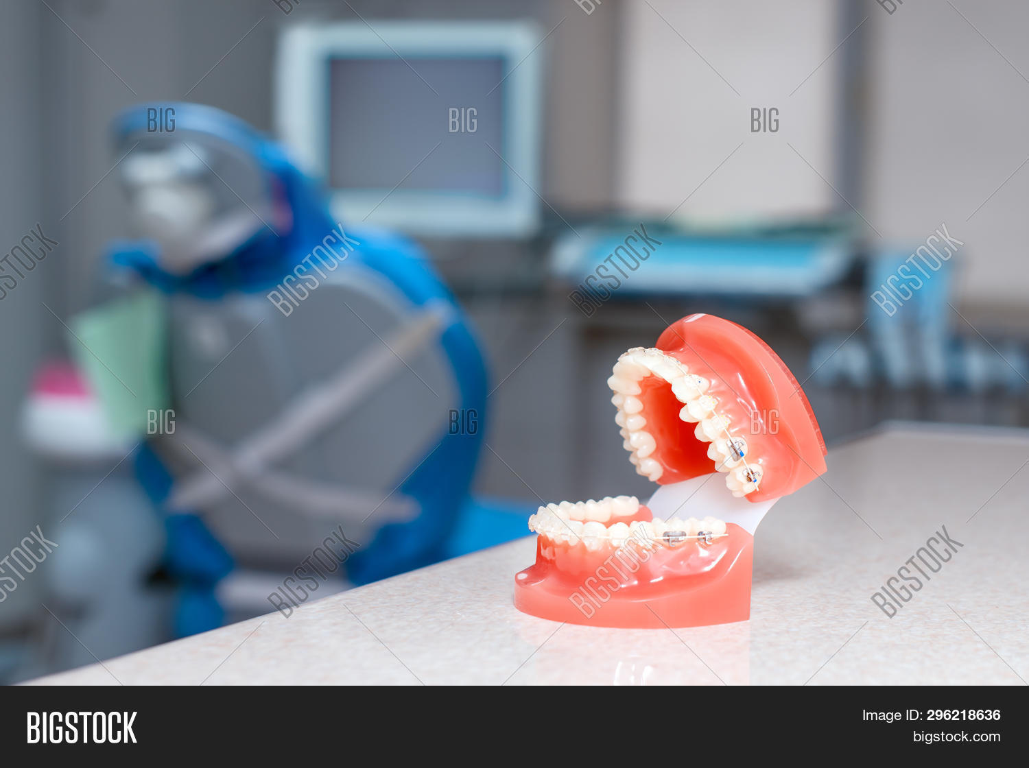 Orthodontic Model Image & Photo (Free Trial) | Bigstock