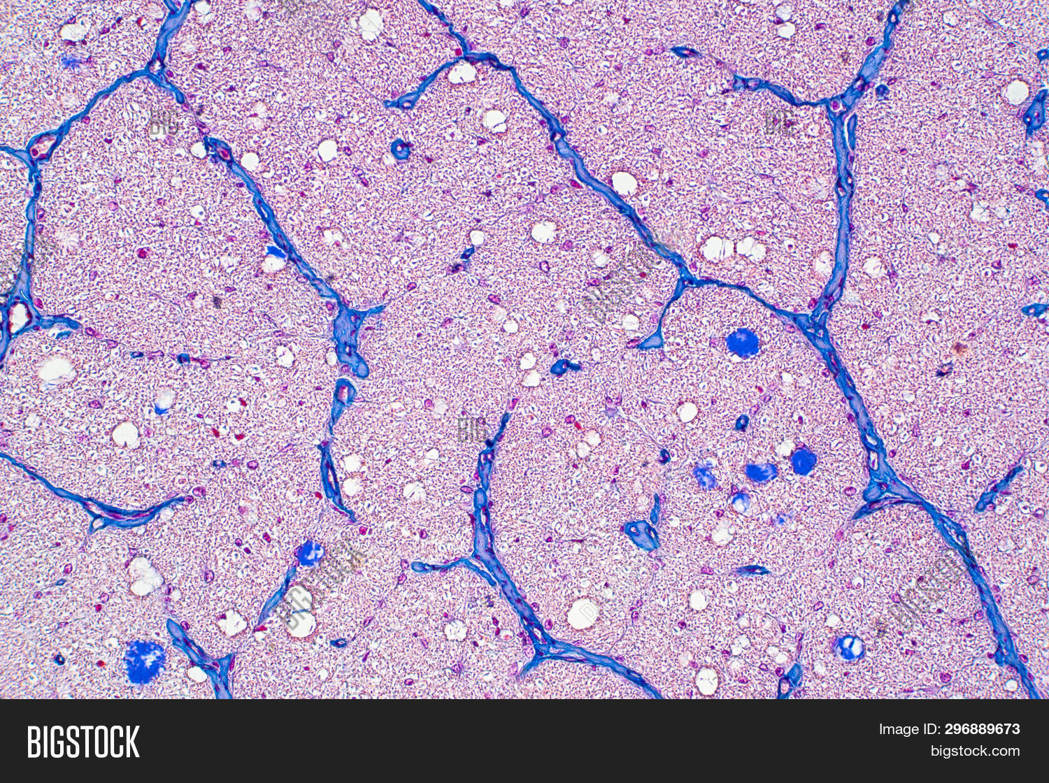 Human Eye Nerve Under Image & Photo (Free Trial) | Bigstock