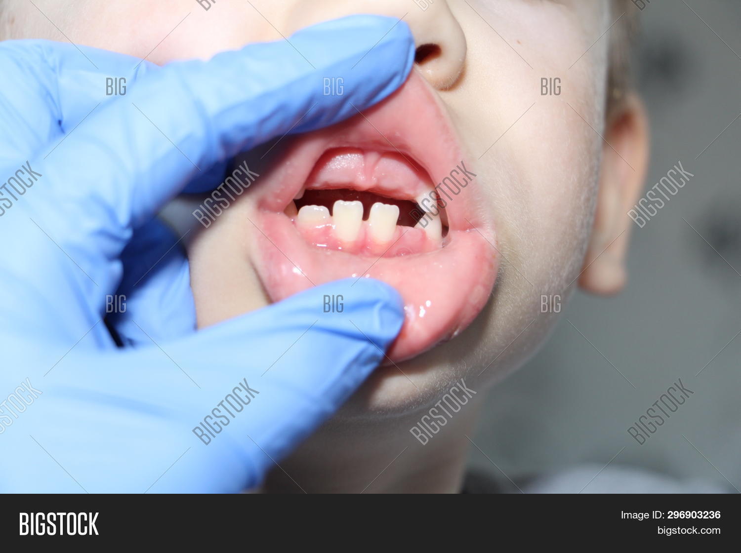 Dentist Examines Baby Image & Photo (Free Trial) | Bigstock