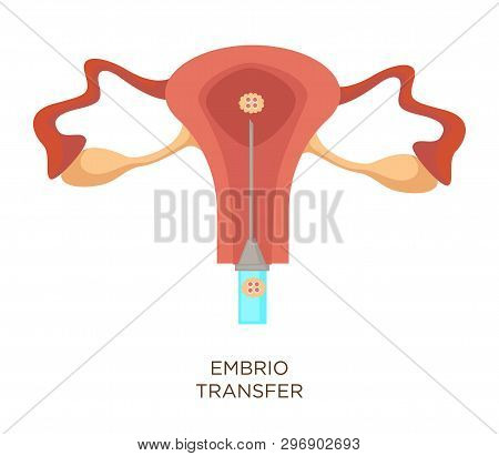 Embryo Transfer Vector & Photo (Free Trial) | Bigstock