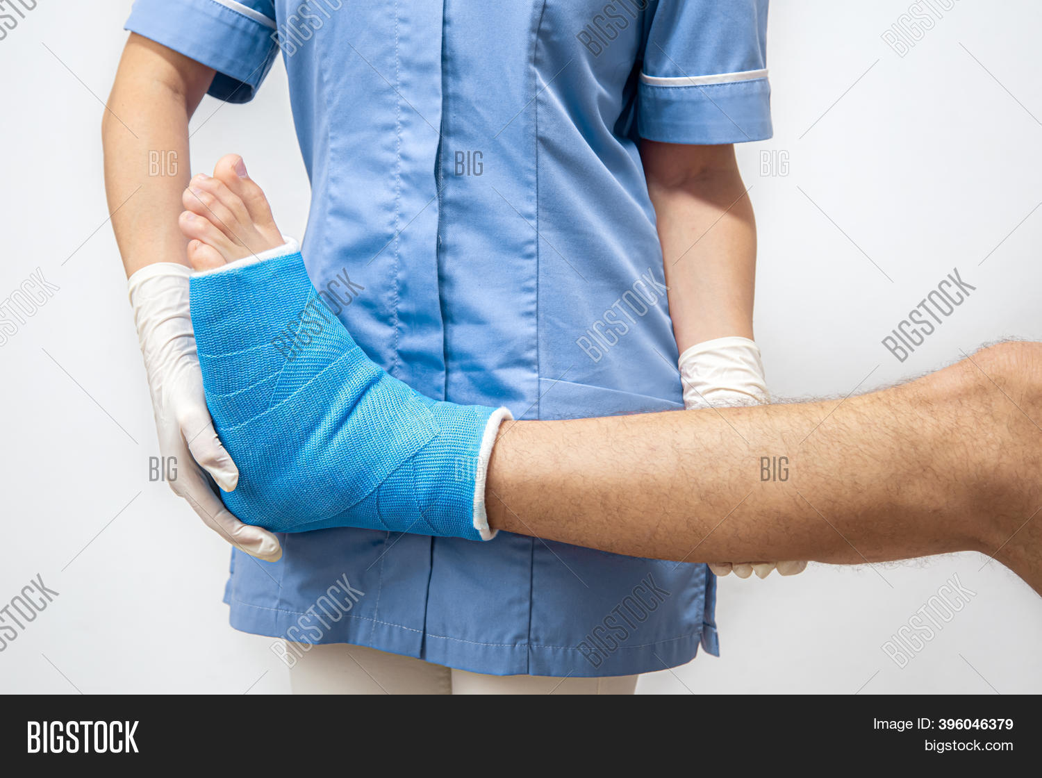 Close Man's Leg Cast Image & Photo (Free Trial) | Bigstock