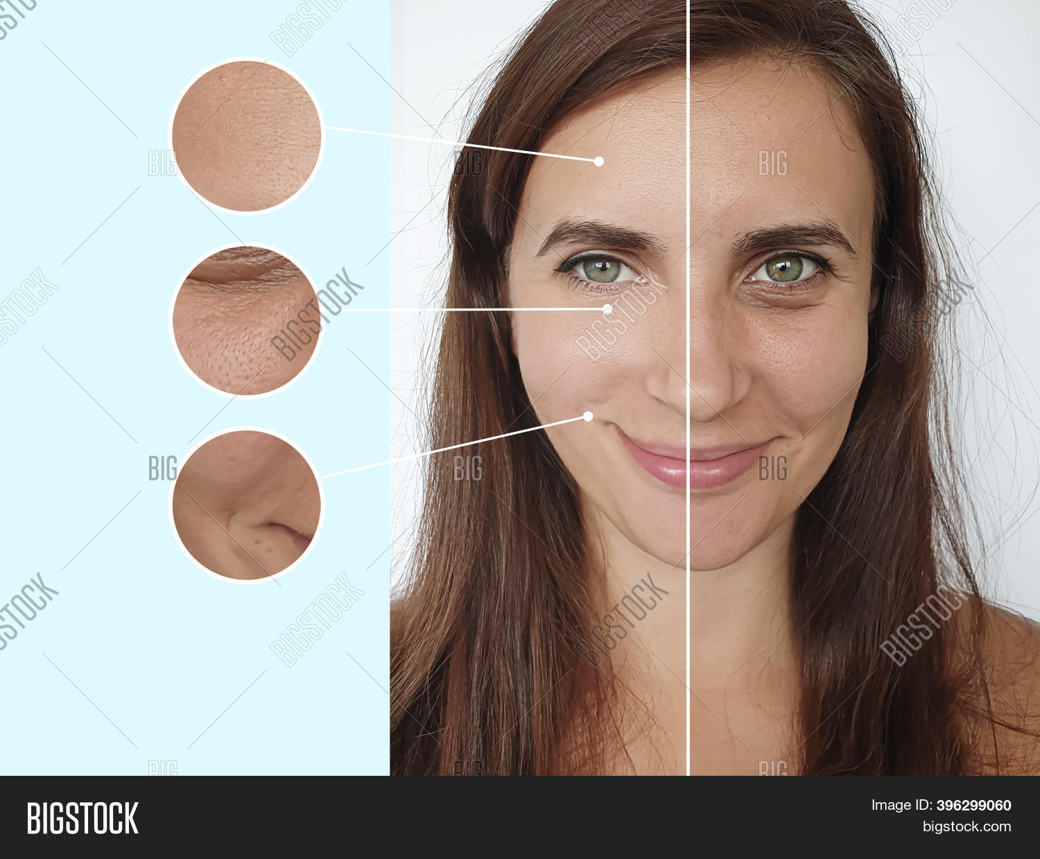 Woman Face Wrinkles Image & Photo (Free Trial) | Bigstock