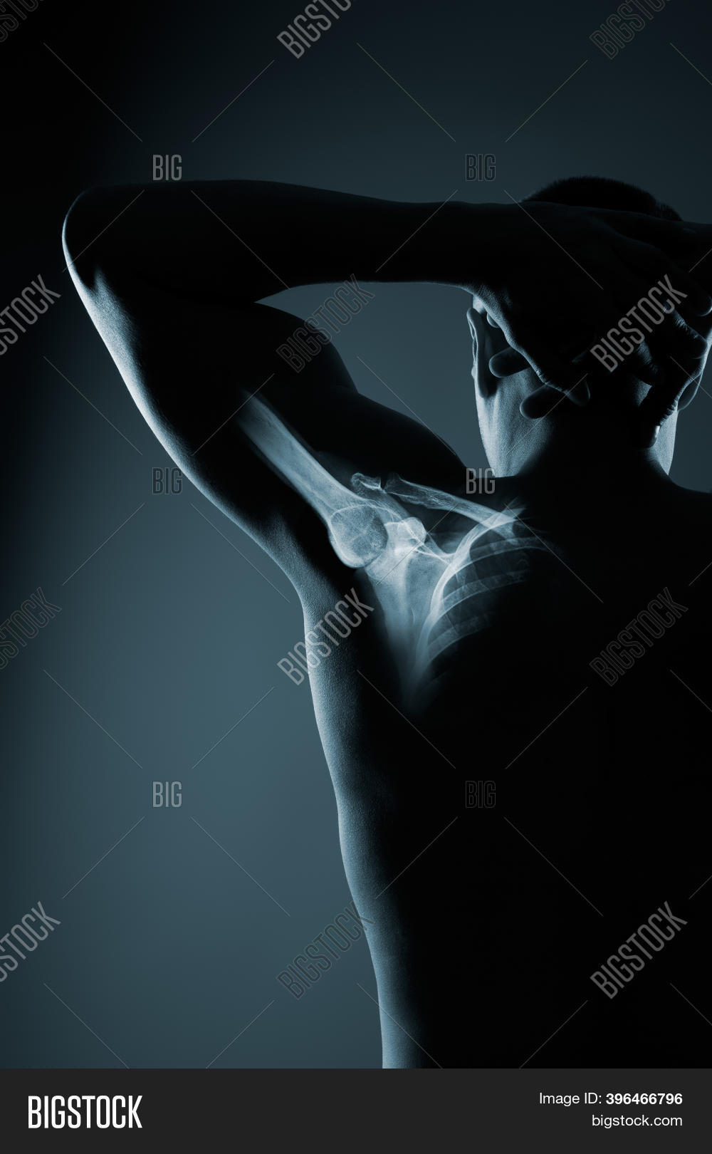 Human Shoulder Joint X Image & Photo (Free Trial) | Bigstock