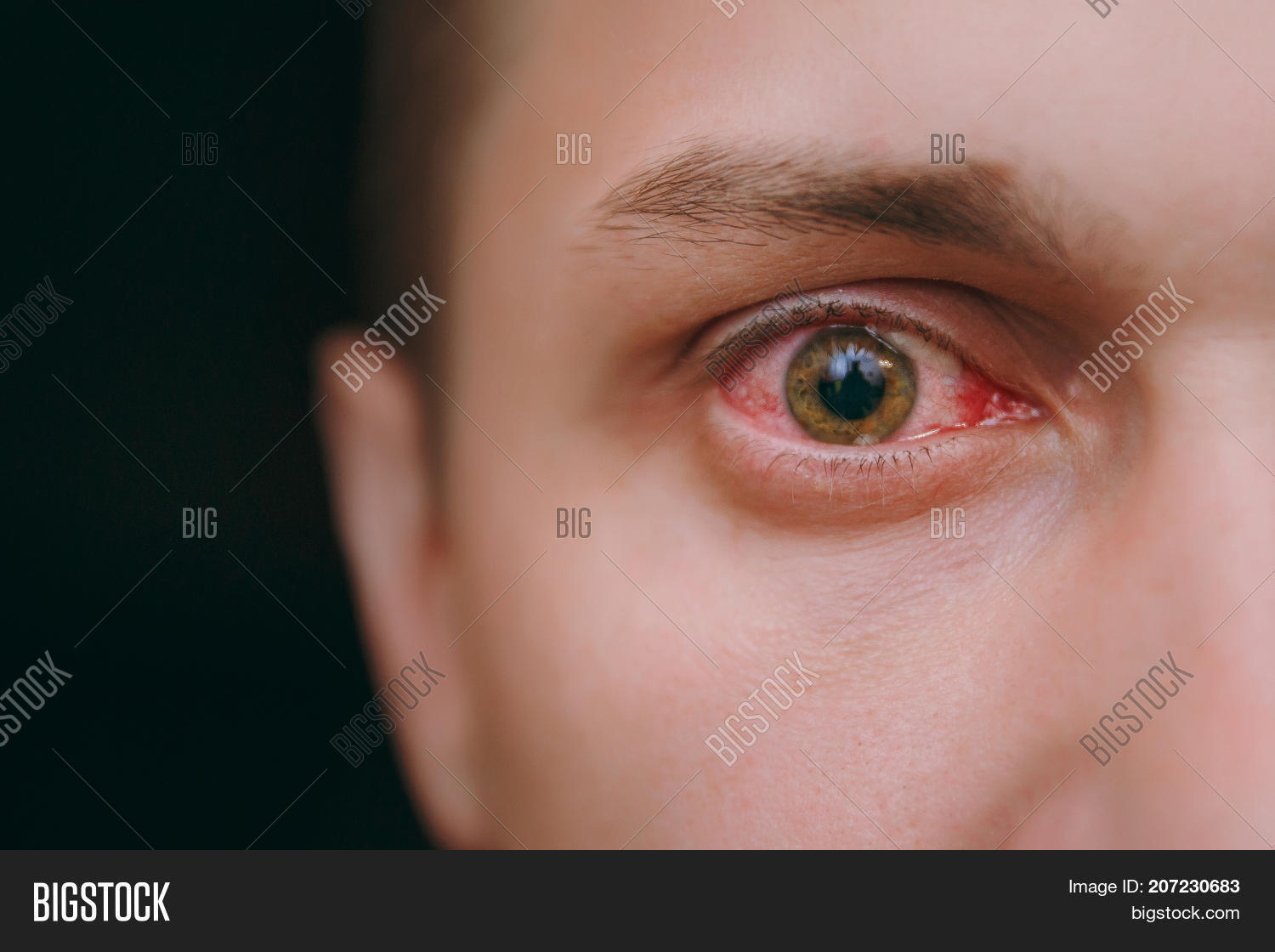 Close One Annoyed Red Image & Photo (Free Trial) | Bigstock