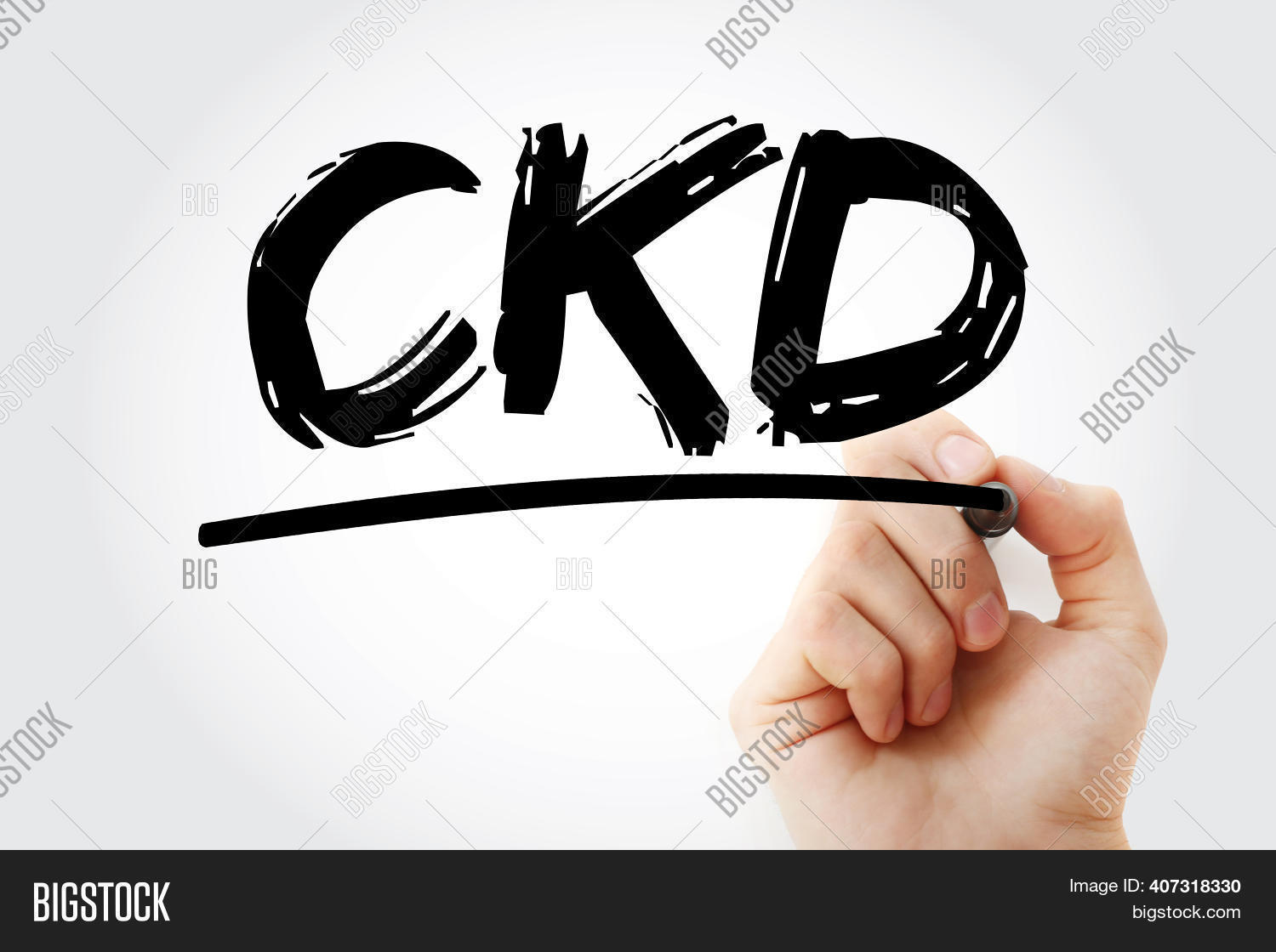 Ckd - Chronic Kidney Image & Photo (Free Trial) | Bigstock