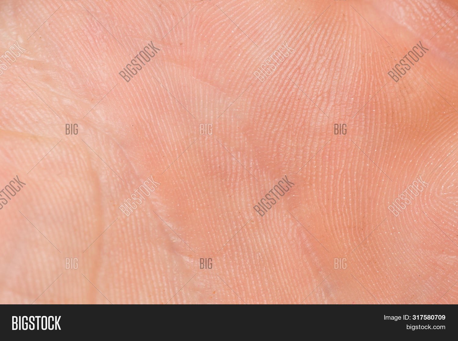 Macro Human Skin. Image & Photo (Free Trial) | Bigstock