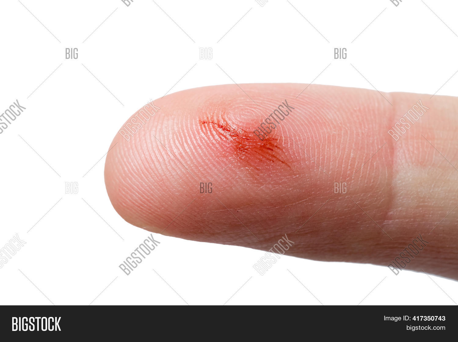 Forefinger Hand Image & Photo (Free Trial) | Bigstock