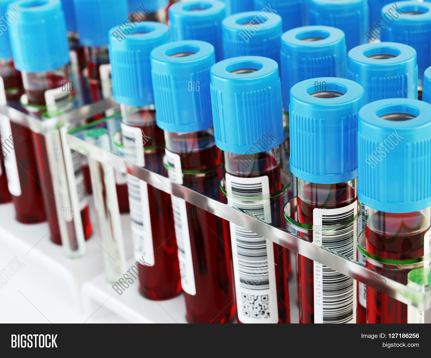 Blood Test Tubes. Image & Photo (Free Trial) | Bigstock
