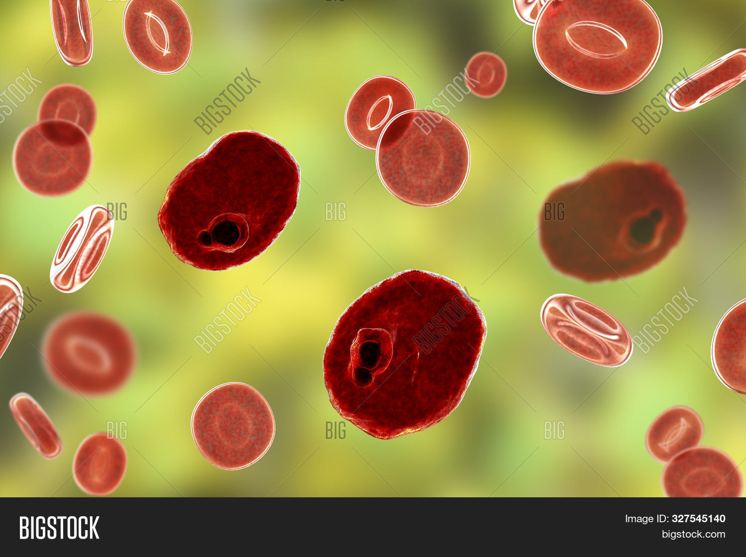 Malaria-infected Red Image & Photo (Free Trial) | Bigstock