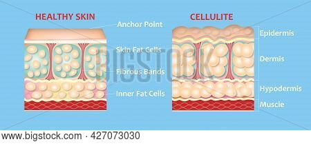 Forming Underskin Image & Photo (Free Trial) | Bigstock
