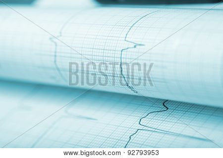 Ecg Chart Medical Image & Photo (Free Trial) | Bigstock