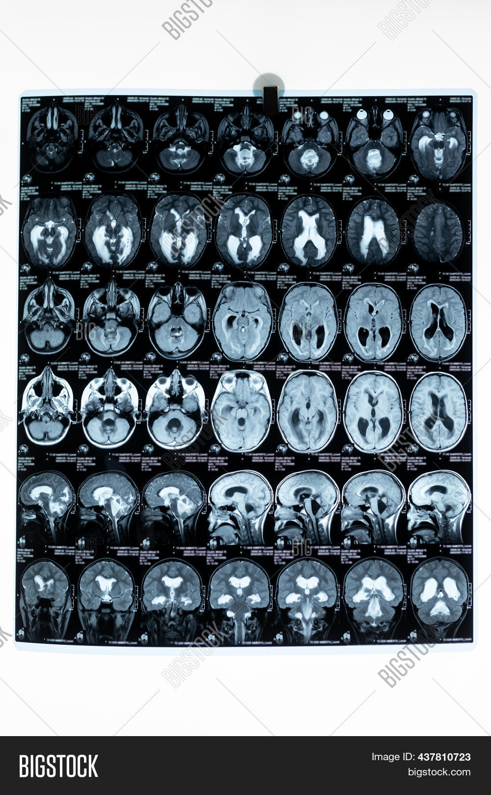 Real Mri Scans Head Image & Photo (Free Trial) | Bigstock