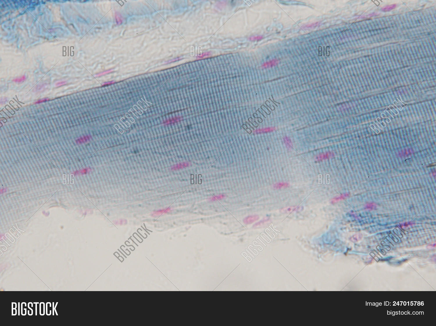 Human Skeletal Muscle Image & Photo (Free Trial) | Bigstock